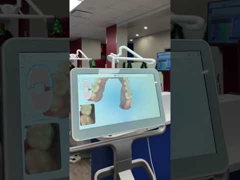New Jersey orthodontic dentists scan bites for a more accurate smile. #dentist #braces #orthodontist
