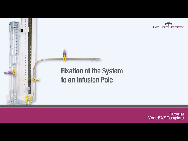 VentrEX® Complete EVD | Ventrex