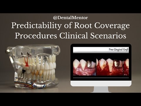 Predictability of Root Coverage Procedures Clinical Scenarios