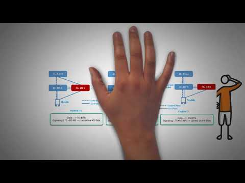 NSA Option-3 Reliability in 5G NR?