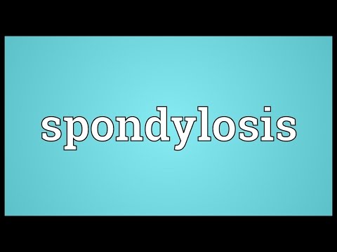 Spondylosis Meaning