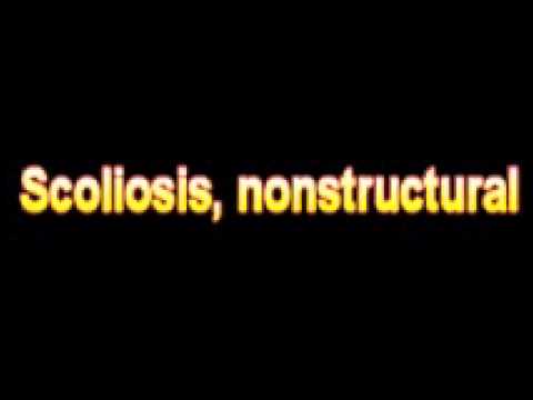 What Is The Definition Of Scoliosis, nonstructural Medical School Terminology Dictionary