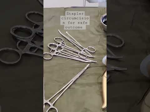 Best circumcision surgery with stapler a day care procedure for safe outcome. #circumcision