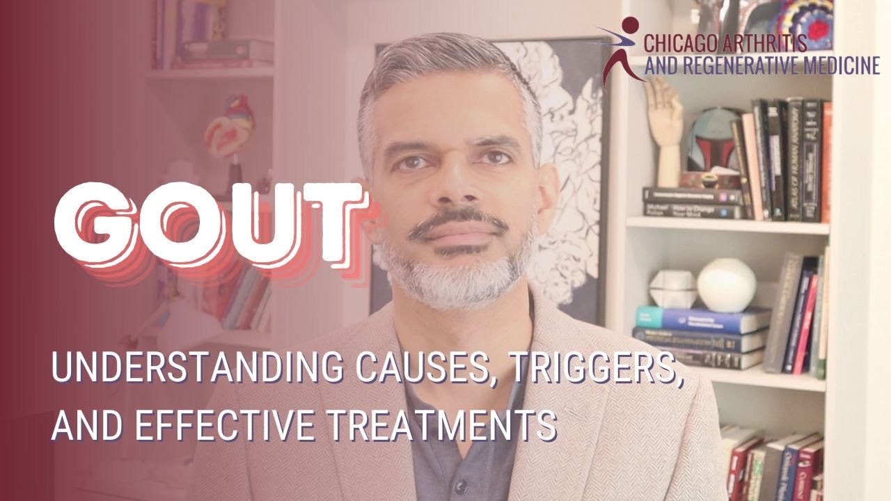 Managing Gout Understanding Causes Triggers And Effective Treatments Chicago Arthritis And