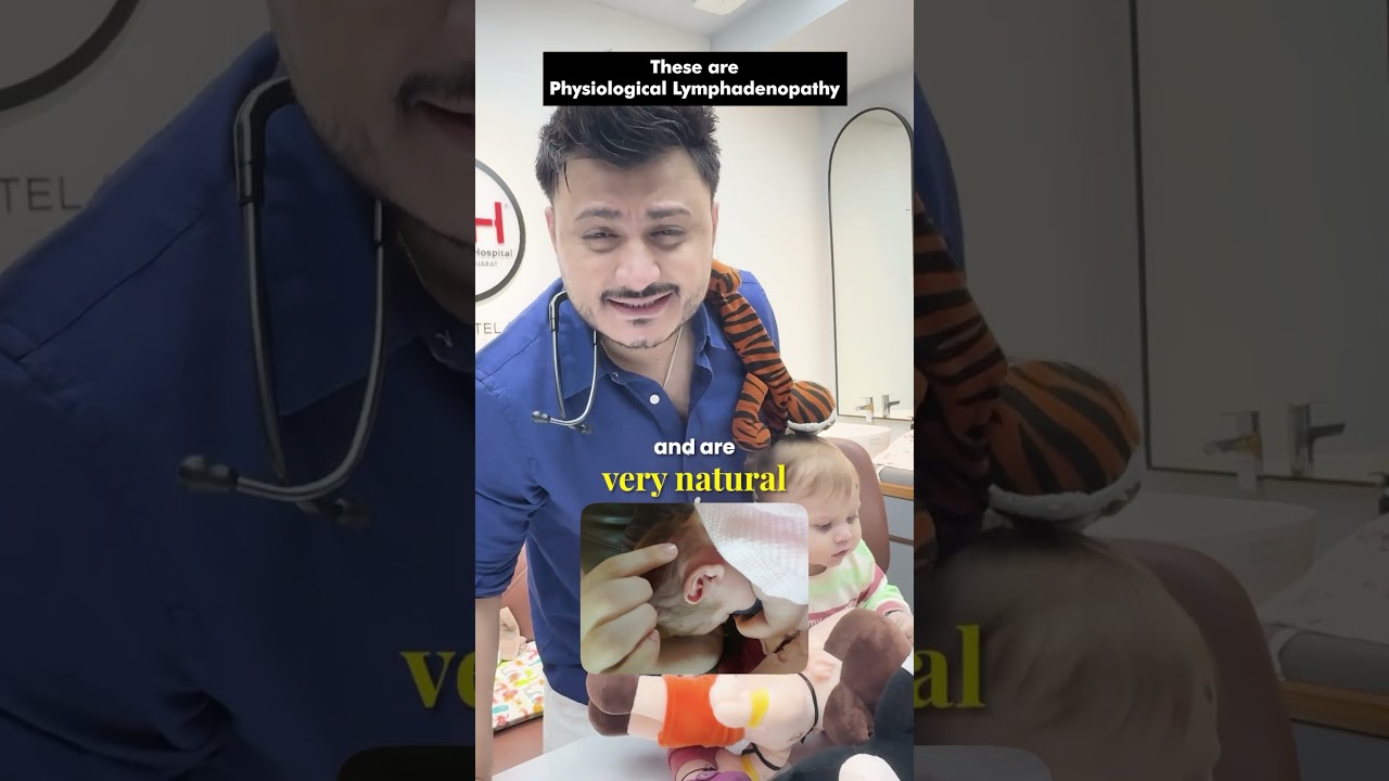 Physiological lymphadenopathy means the presence of palpable lymph nodes that are normal in children