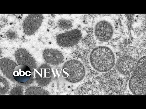 7 people in the US confirmed or presumed to have monkeypox in 5 states l ABCNL