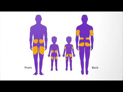 Omnipod® 5 Automated Insulin Delivery System Product Training - Overview