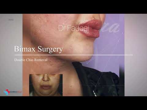 Dr. Mohsen Fadaee (Plastic Surgeon in Iran)
