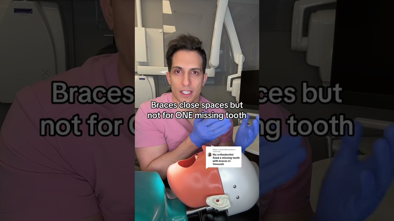 Braces Close Gaps, But Not Missing Teeth!
