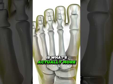 Do Bunion Correctors Work How To Shrink Bunions Naturally Tom