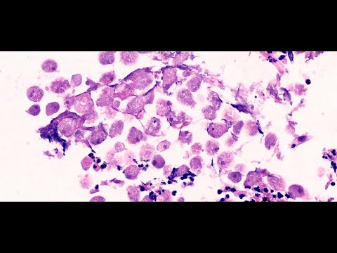 Parasites - AMOEBIC COLITIS - QUIZ CASE 01 - DIGIPATH TUTORIALS