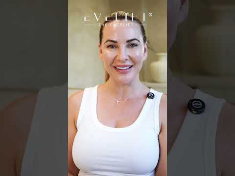 Sheila's EVE Lift™ Journey | Eden Plastic Surgery: Dr. Ali Charafeddine, MD | Miami, FL