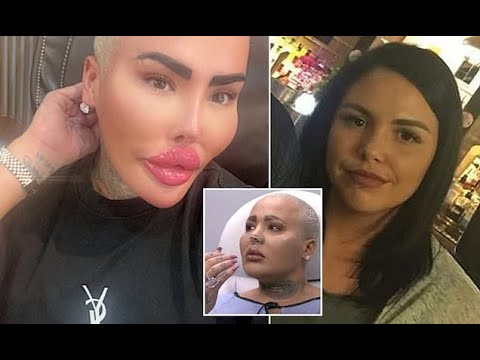 Bizarre life of surgery obsessed 'Lip King' linked to Alice Webb BBL death and what he looked like