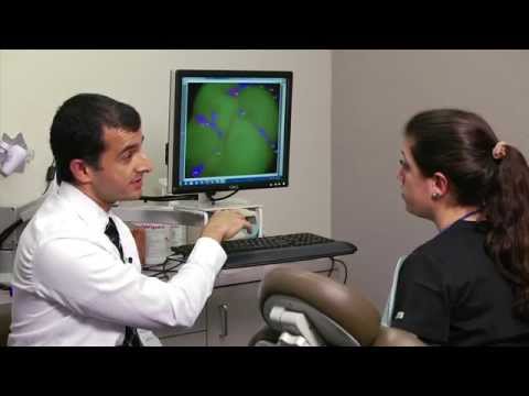 Laser Fluorescence Caries Detector Camx Spectra Air