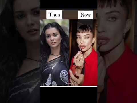3 Failed Plastic Surgeries In Bollywood #shorts #bollywood #youtubeshorts