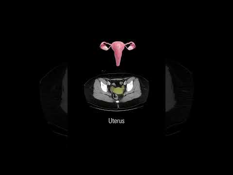Axial CT Scan of #abdomen and #pelvis #radiology #anatomy#medical #doctor#ctscan#imaging#radiogyan