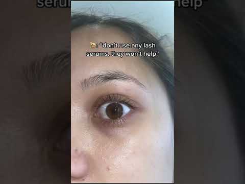 BEST lash serum I’ve ever tried