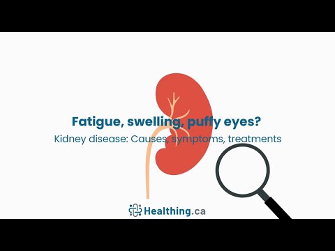 Fatigue, swelling, puffy eyes: Do you know the signs of kidney disease ...