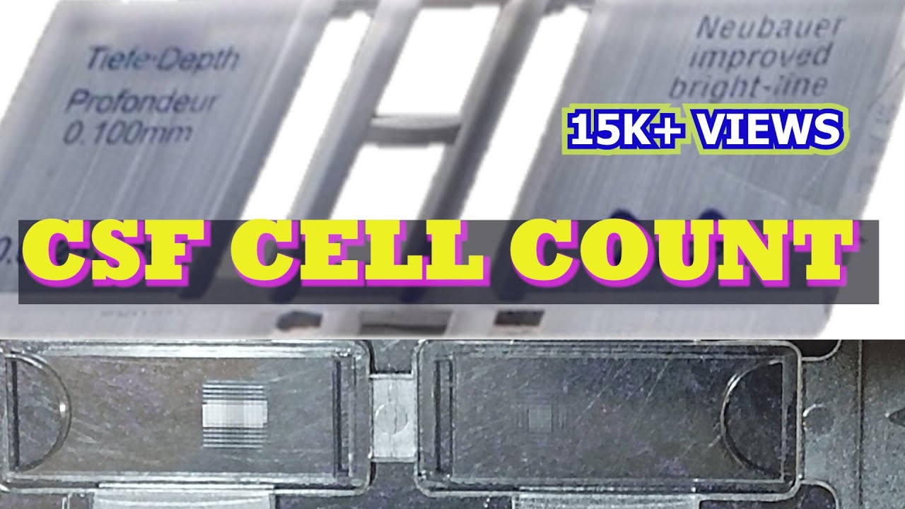CSF CELL COUNT