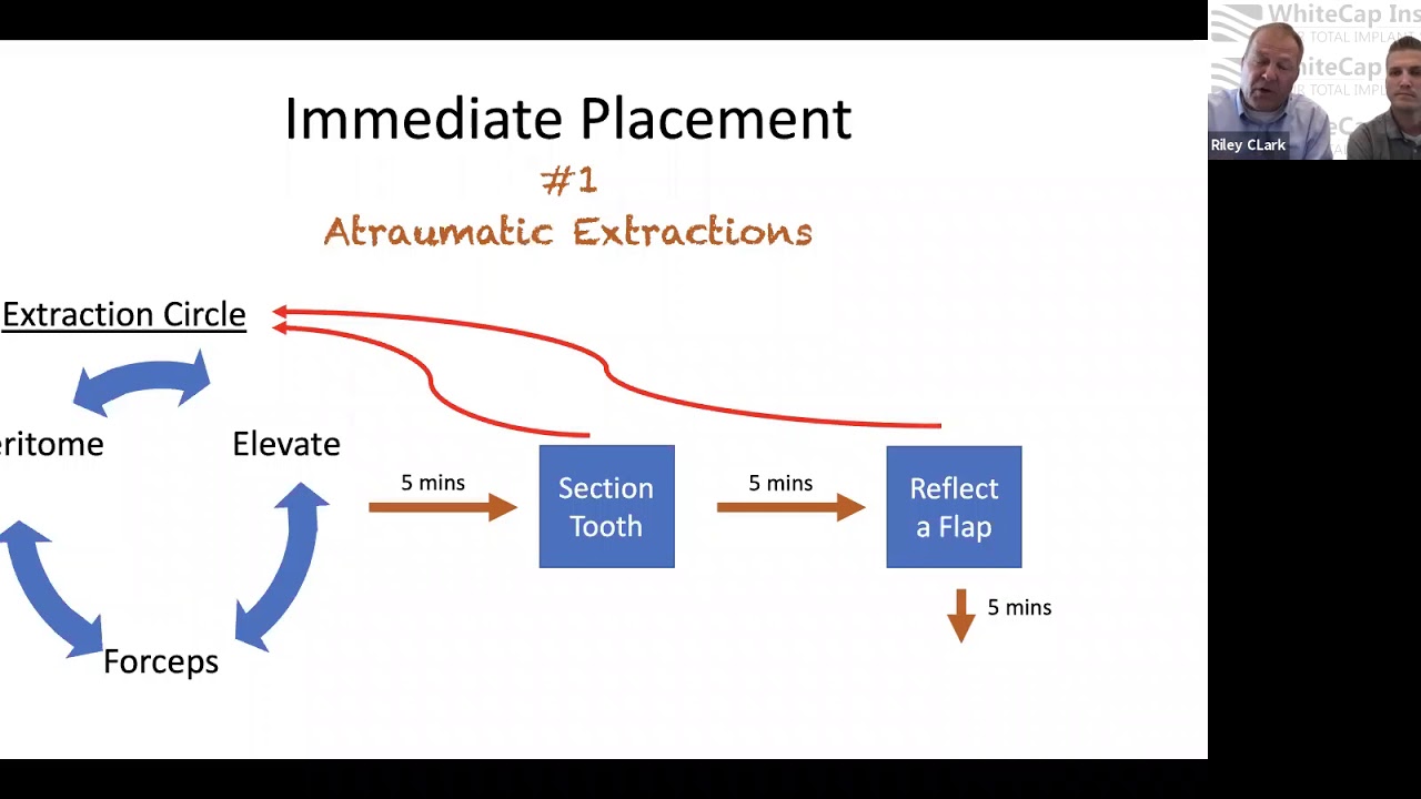 Immediate Placement and Immediate Load