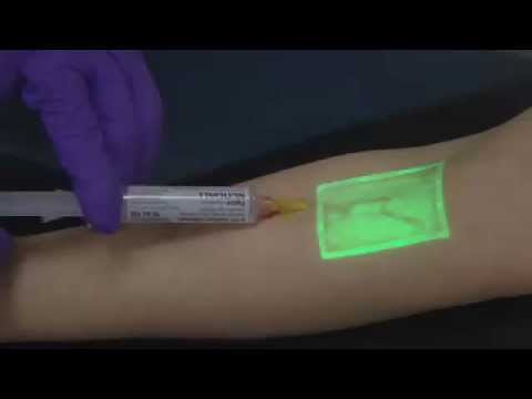 Here's a Useful Medical Device That Shows a Patient's Veins - Softpedia
