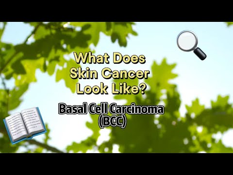 What Does Skin Cancer Look Like? Basal Cell Carcinoma