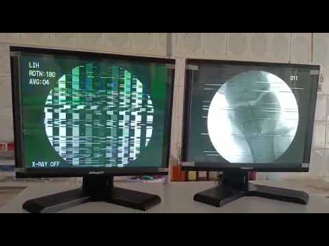 Computer Monitor Repair Services, CRT Monitor Repairing Service in India