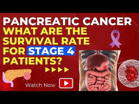 PANCREATIC CANCER | WHAT ARE THE SURVIVAL RATE FOR STAGE 4 PATIENTS