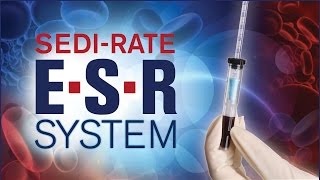 Globe Scientific ESR Sedi Rate Westergren System, Pipettes and Citrate ...