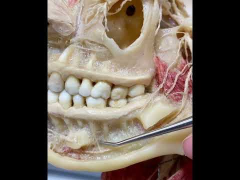 Inferior Alveolar Nerve