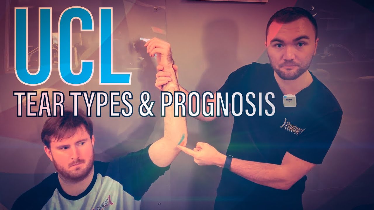 UCL Tear: Types and Prognosis