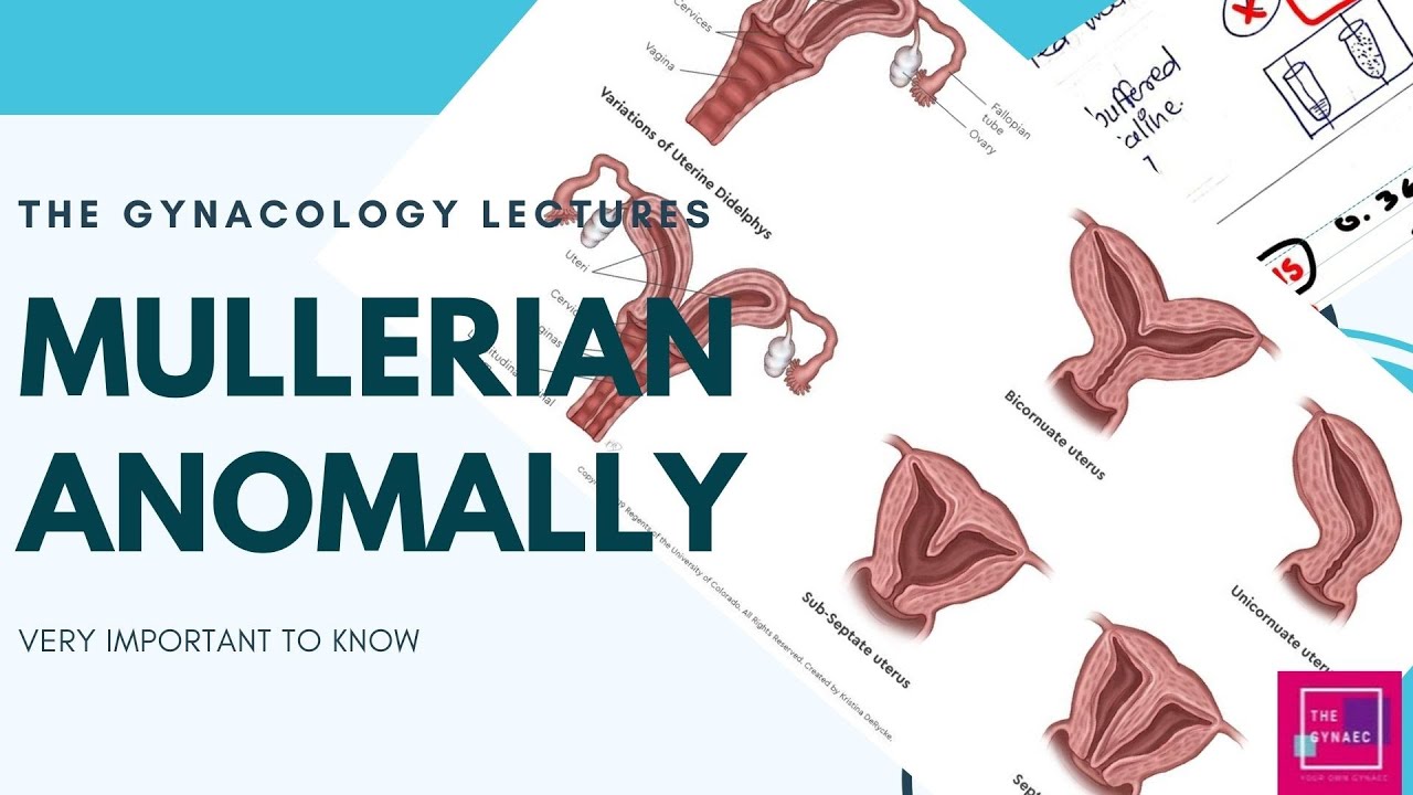 Mullerian Anomaly - Concept and Classfication