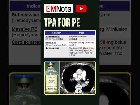 TPA for Pulmonary Embolism #doctor #medical