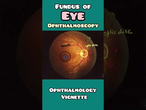 Fundus of an EYE explained simply in less than 60 seconds ! USMLE, NEET PG, NCLEX