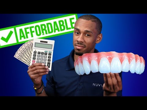 Affordable Dental Implants? How They Made It Possible!