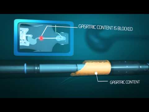 LunGuard - Foreign Startup | Startup Nation Finder