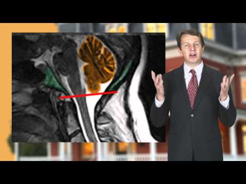 MRI - How it Works, Part 2 The Different Types