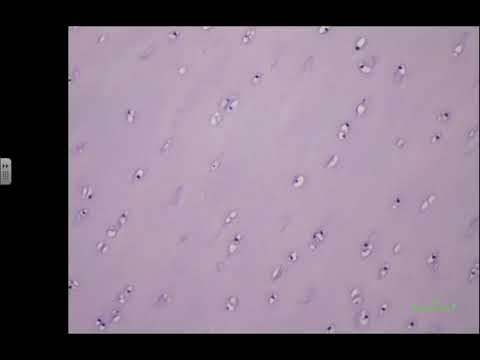 Boot Camp 3 - Cartilage