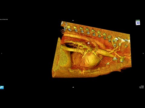 Vascular ring anomaly PRAA found in puppy by Vimago HDVI