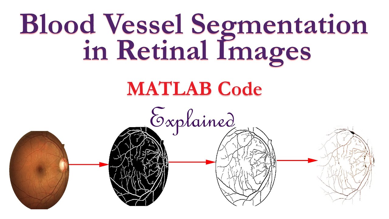 Segmenting Blood Vessels in Retinal Images Using MATLAB | Galaxy.ai