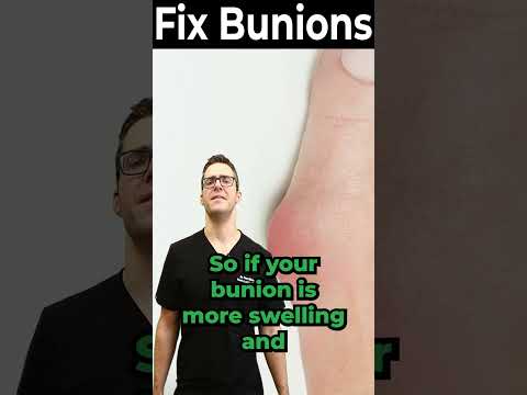 Bunion Pain Relief with Medication? [NSAIDs, Steroids & Creams]