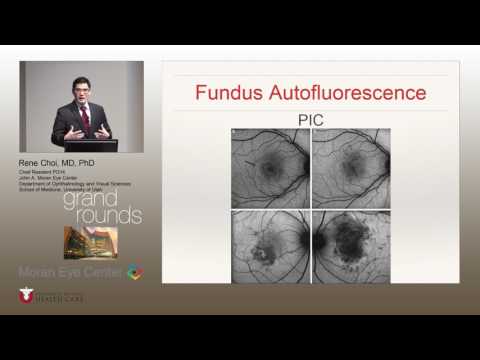 Punctate Inner Choroidopathy (PIC)
