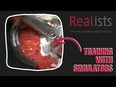 Lumbar Spine Facetectomy (Prof. Dr. Enrico Tessitore)