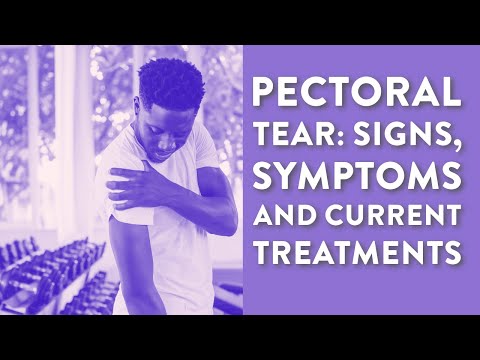 Pectoral tear: Signs, symptoms and current treatments