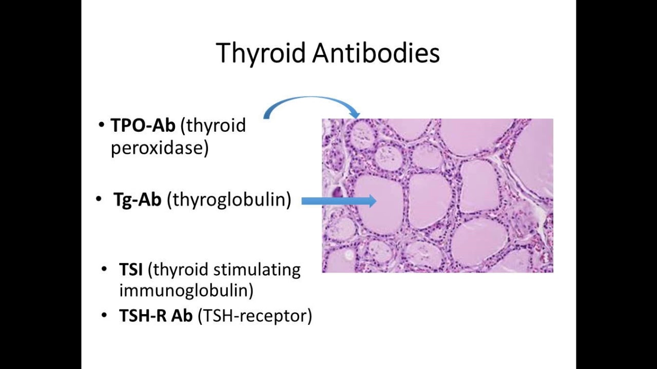 2016: Interpreting Abnormal Thyroid Function Tests & Understanding Indications for Treatment