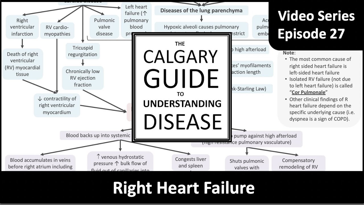 Right Heart Failure: Pathogenesis and Clinical Findings