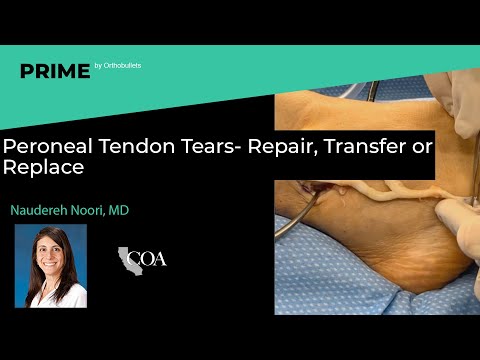 Peroneal Tendon Tears: Repair, Transfer or Replace - Naudereh Noori, MD