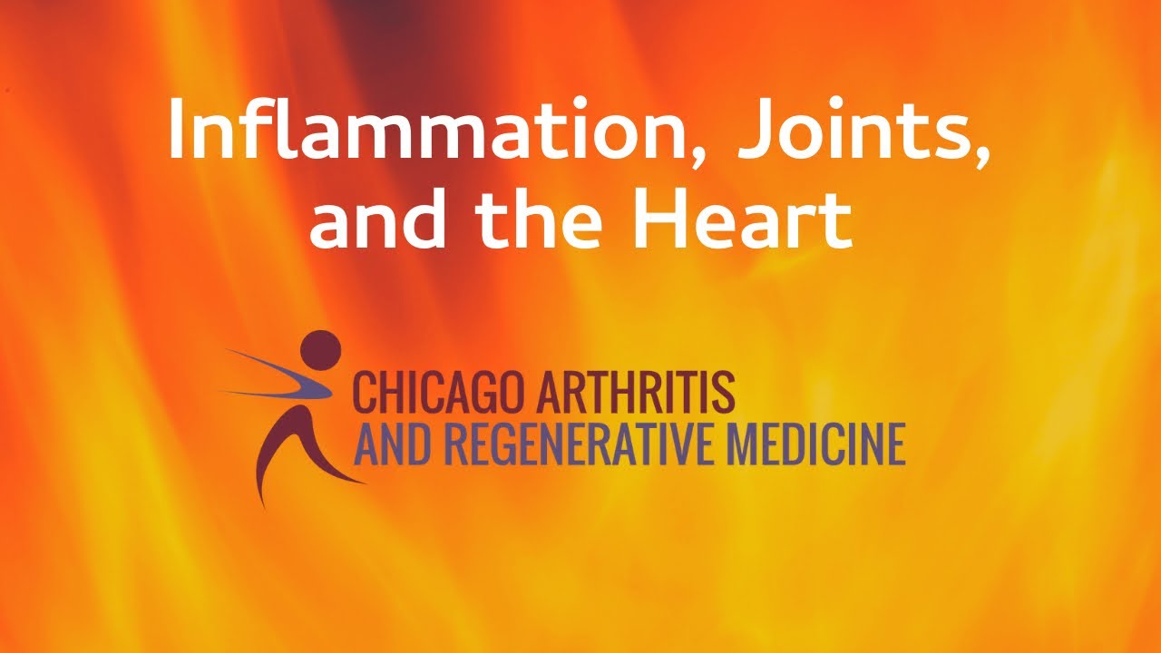Inflammation, Joints, & Heart Disease | Chicago Arthtritis