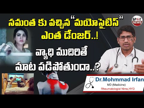 Rheumatologist Dr.Mohmmad Irfan Clarity on Samantha Ruth Prabhu Health | Myositis Effects & Remedies