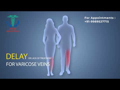 Painless and Minimally Invasive Treatment for Varicose Veins